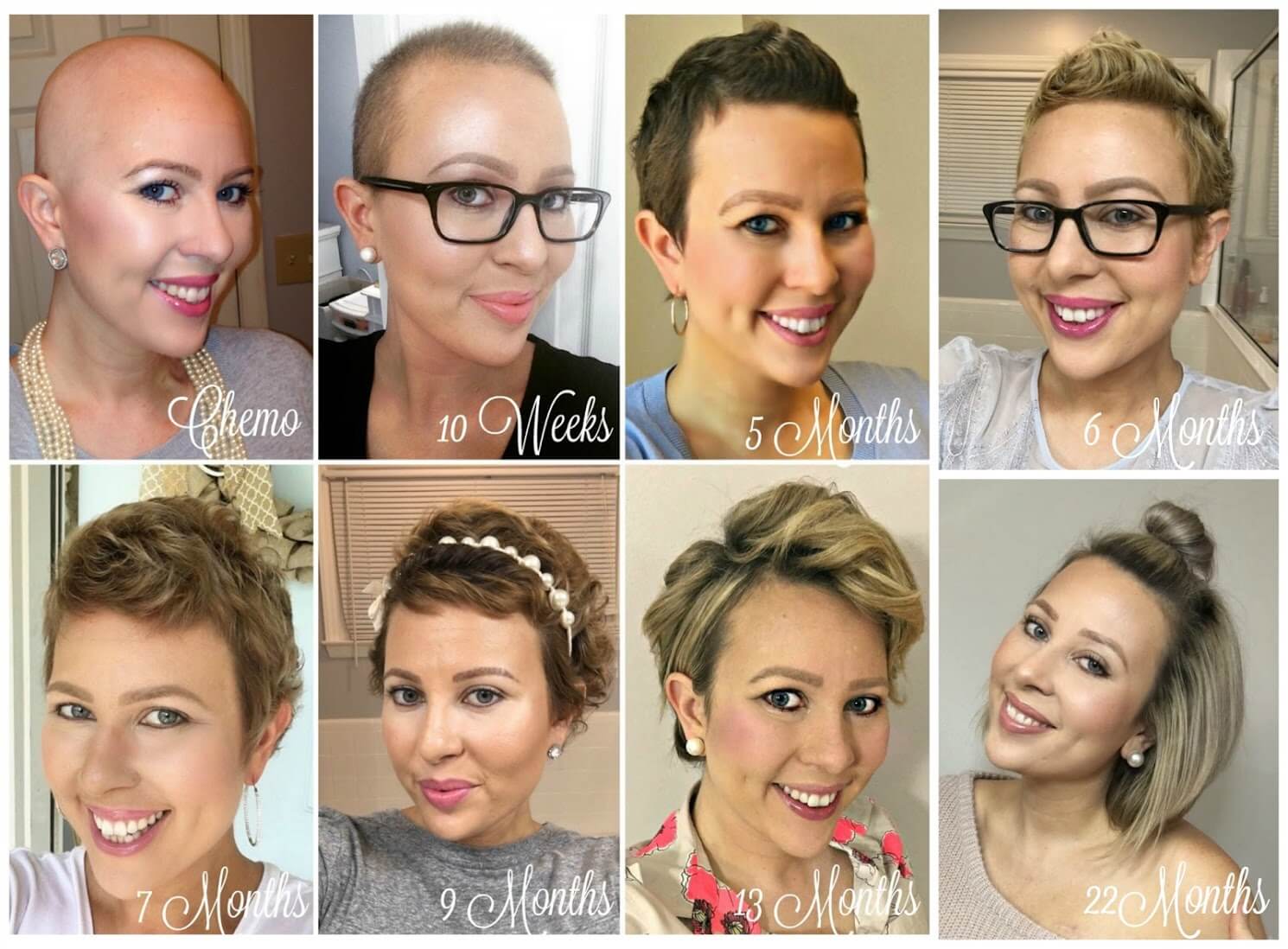 Bald to Beautiful Tresses: A Thriver's Hair Loss Guide - Cancer Be Glammed